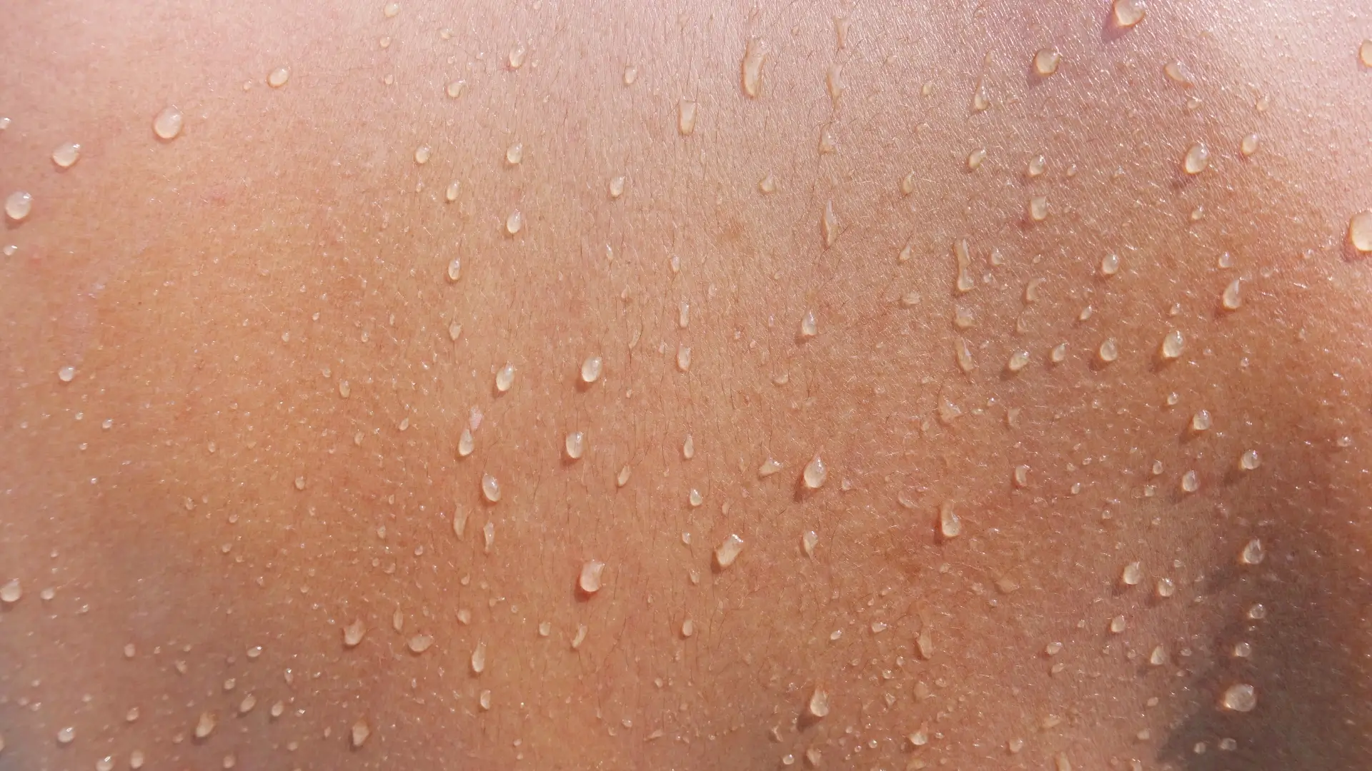 Transpiration excessive - Comprendre les causes - BioMed MTC